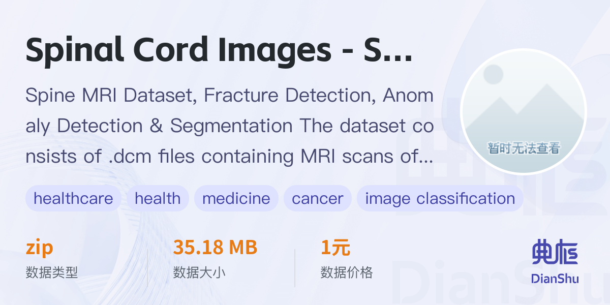 Spinal Cord Images - Spine MRI Dataset - 典枢