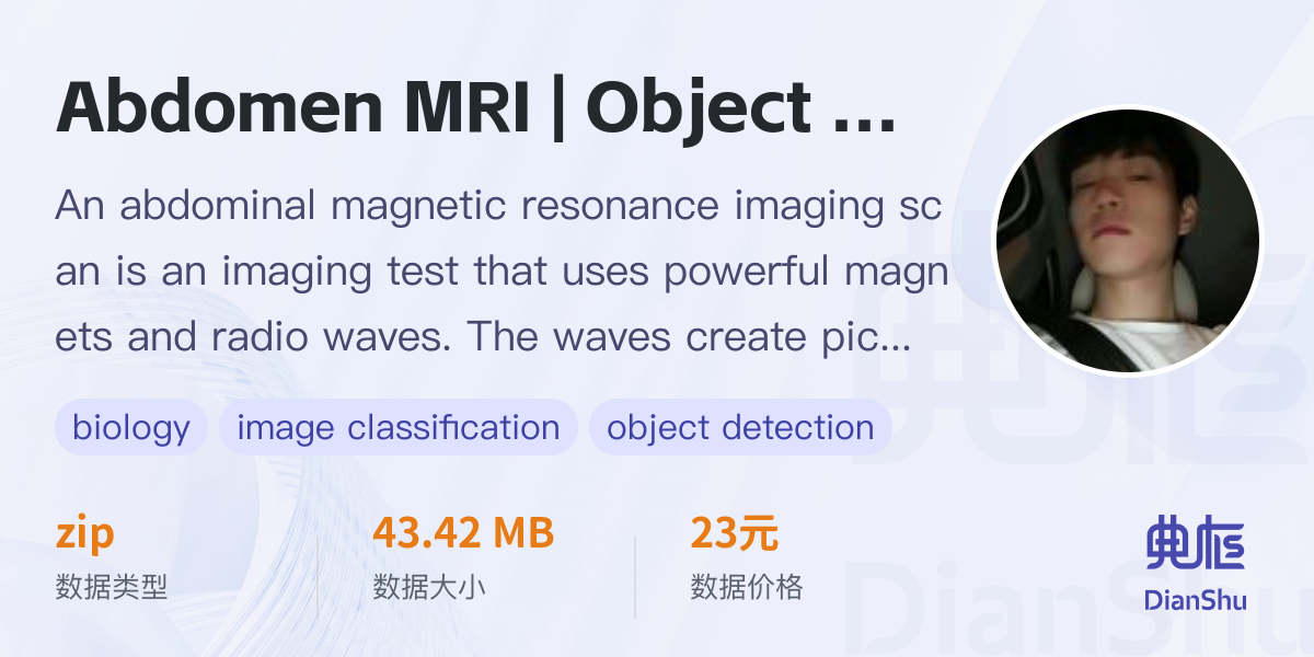 Abdomen MRI | Object Detection - 典枢